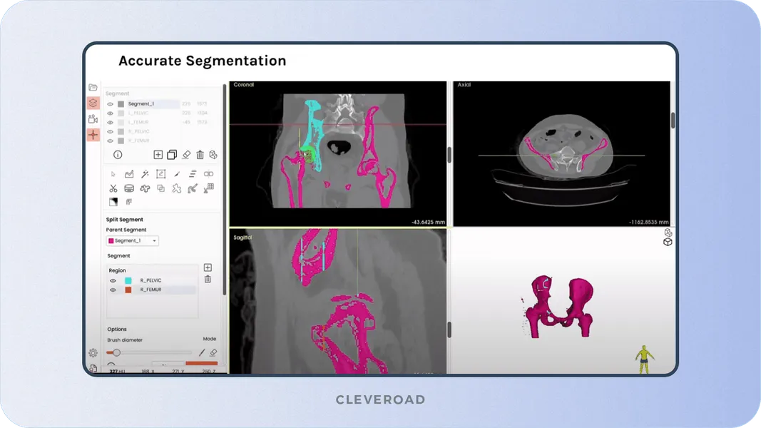 How to Develop Hospital Management System in 2024: The Full Guide